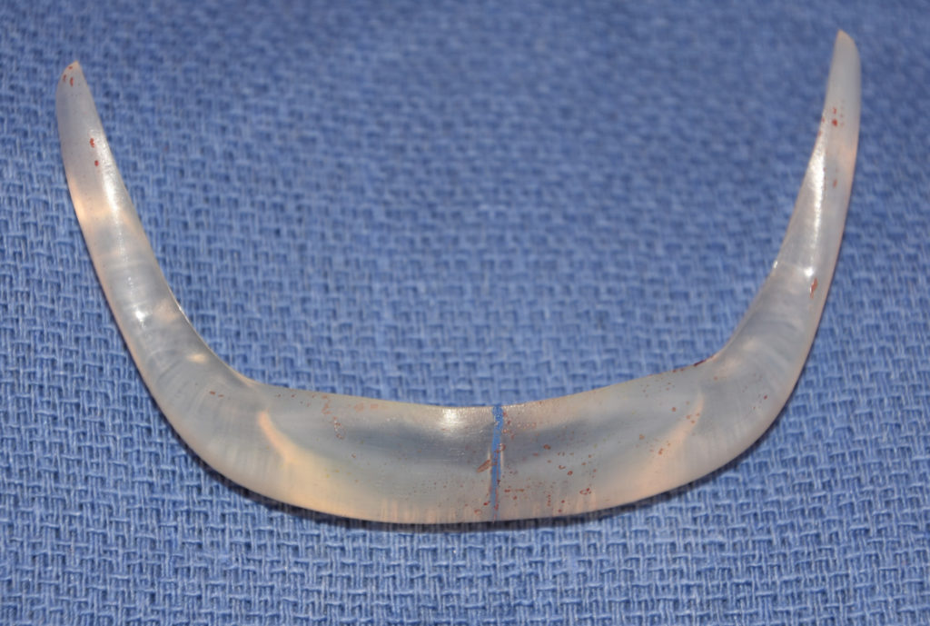 Square Chin Implant Styles for Men - Explore Plastic Surgery