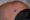 Technical Strategies - Mapping and Incisions for Temporal Artery ...