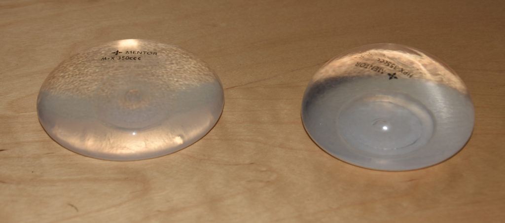 Product Review - Mentor Xtra Breast Implants - Explore Plastic Surgery