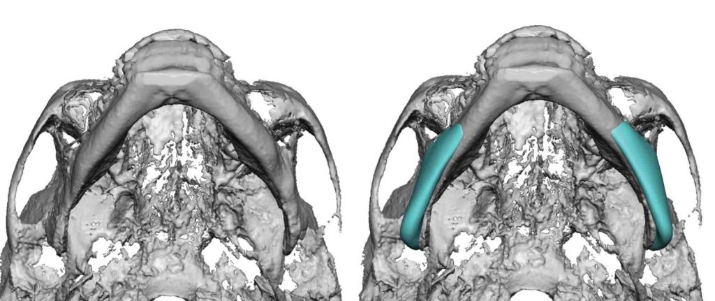 Jaw Angle Implant design for Sagittal Split Deformity bottom view Dr ...