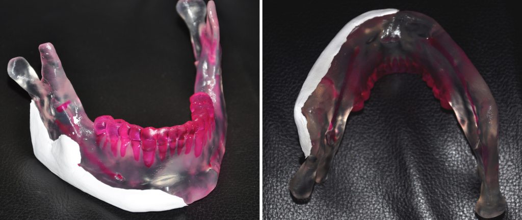 Plastic Surgery Case Study - The Use of Anatomic Models in The ...