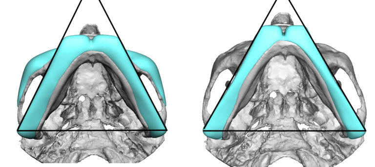 The Equilateral Triangle Concept in Custom Jawline Implant Design ...