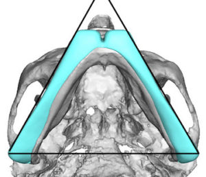 The Equilateral Triangle Concept in Custom Jawline Implant Design ...