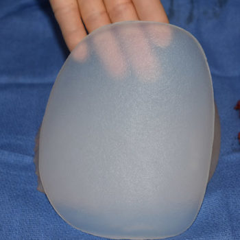 pectoral implants Archives - Explore Plastic Surgery