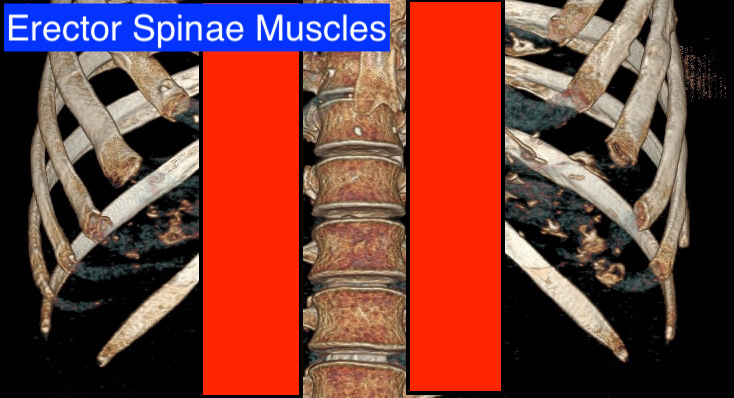 Rib Removal in Waist Narrowing Surgery and The Misconception of Loss of ...