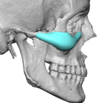 cheek implants Archives - Page 2 of 7 - Explore Plastic Surgery