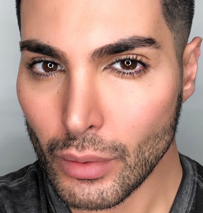 Custom Facial Implants - II. 3D Chin and Jaw Angle Reshaping - Explore ...