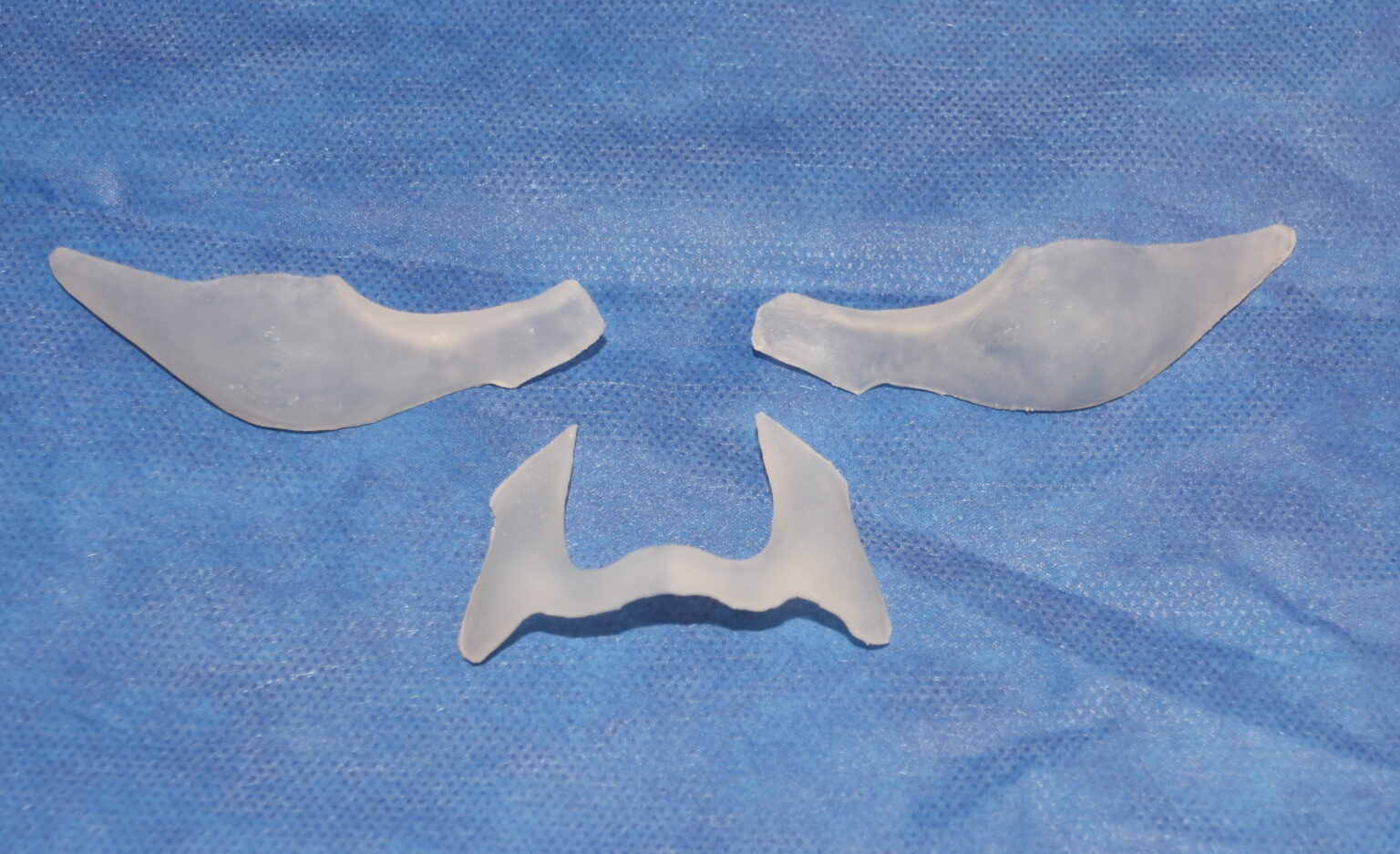 Plastic Surgery Case Study - Custom Midface (Infraorbital-Malar ...