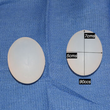 testicular implants Archives - Page 3 of 5 - Explore Plastic Surgery