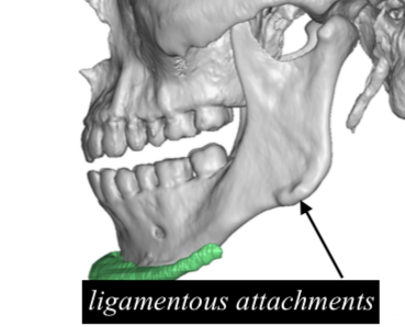 strong ligamentous attachments of the jaw angle 3D CTscan Dr Barry ...
