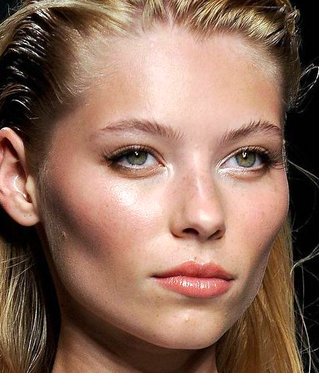 Plastic Surgery Case Study - Custom Infraorbital-Malar Implants for the ...