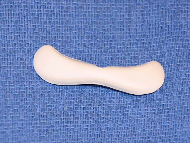 ePTFE Premaxillary and Paranasal Implants for Central Midface ...