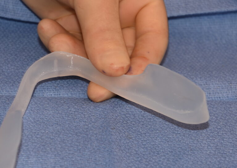 Technical Strategies - The Direct Transcutaneous Approach to Jaw Angle ...