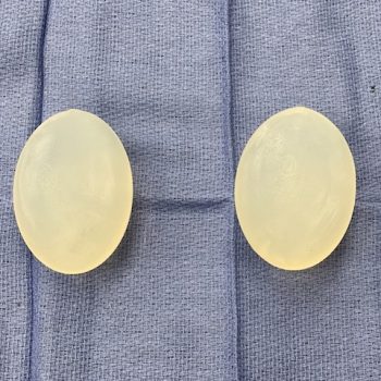 testicular implants Archives - Page 4 of 7 - Explore Plastic Surgery