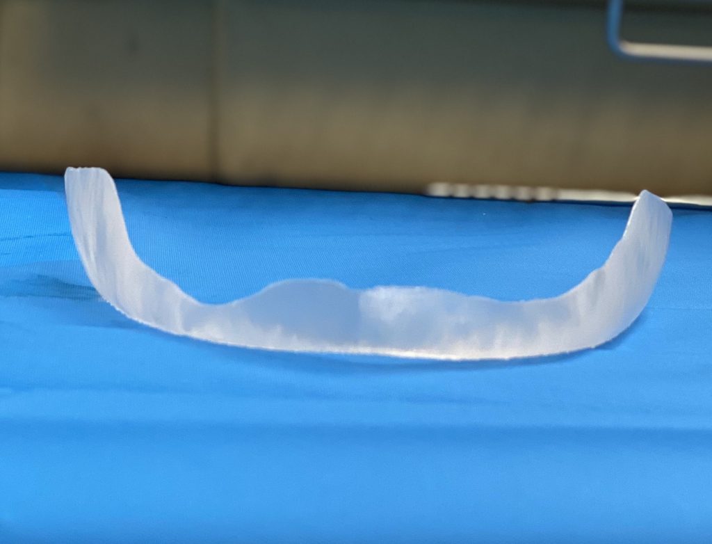 Custom Jawline Implant Designing for V Line Jaw Reduction Restorations ...