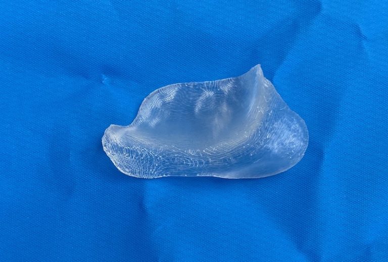 Plastic Surgery Case Study - Comprehensive Vertical Orbital Dystopia ...