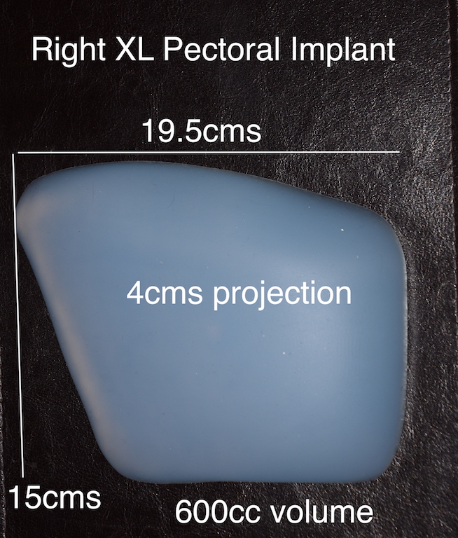 Preoperative Measurements and Sizing for Standard and Custom Pectoral ...