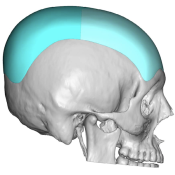 forehead augmentation Archives - Explore Plastic Surgery