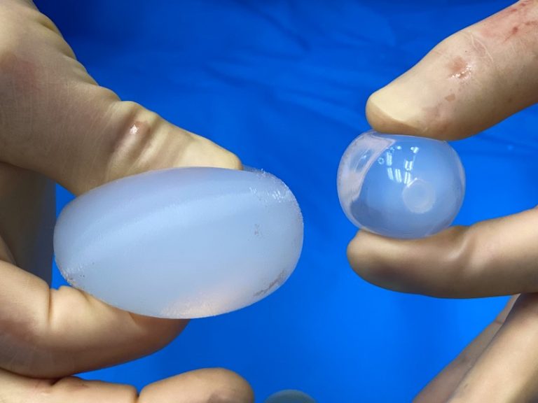 silicone testicle implants are softer than saline implants Dr Barry ...