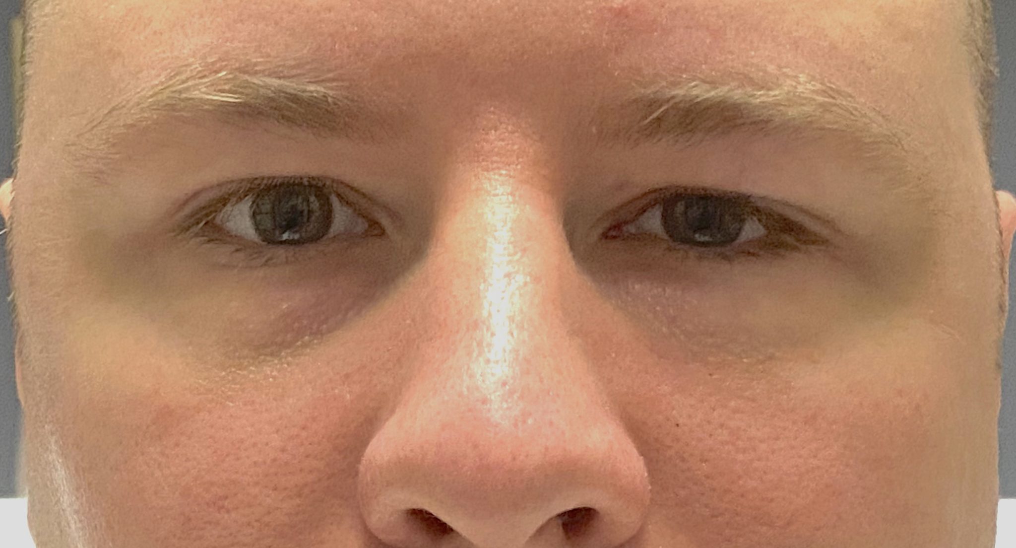 Plastic Surgery Case Study - Outcome from Comprehensive Six Step ...