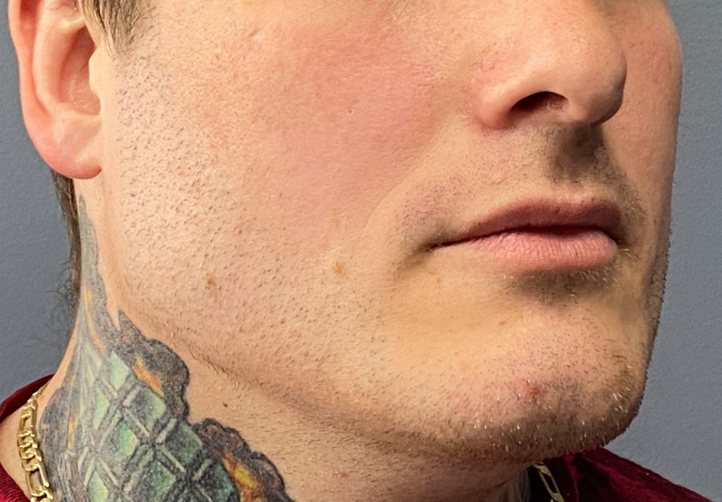 Plastic Surgery Case Study - The Importance of Multi-View Assessment in ...