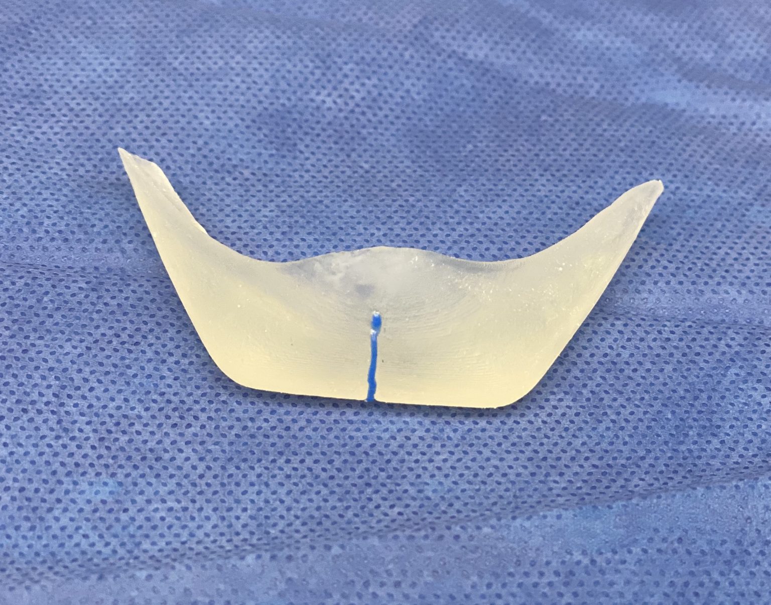 Design Considerations in Square Chin Implants - Explore Plastic Surgery