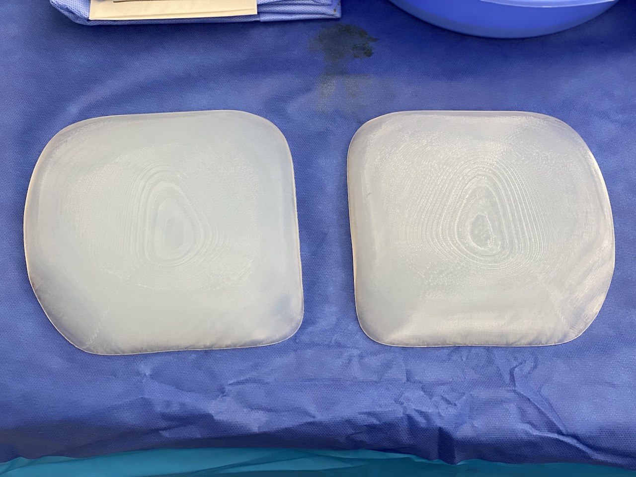 Plastic Surgery Case Study - Custom XL Pectoral Implants in the Male ...