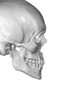 male facial 3D CT scan side view Dr Barry Eppley Indianapolis - Explore ...