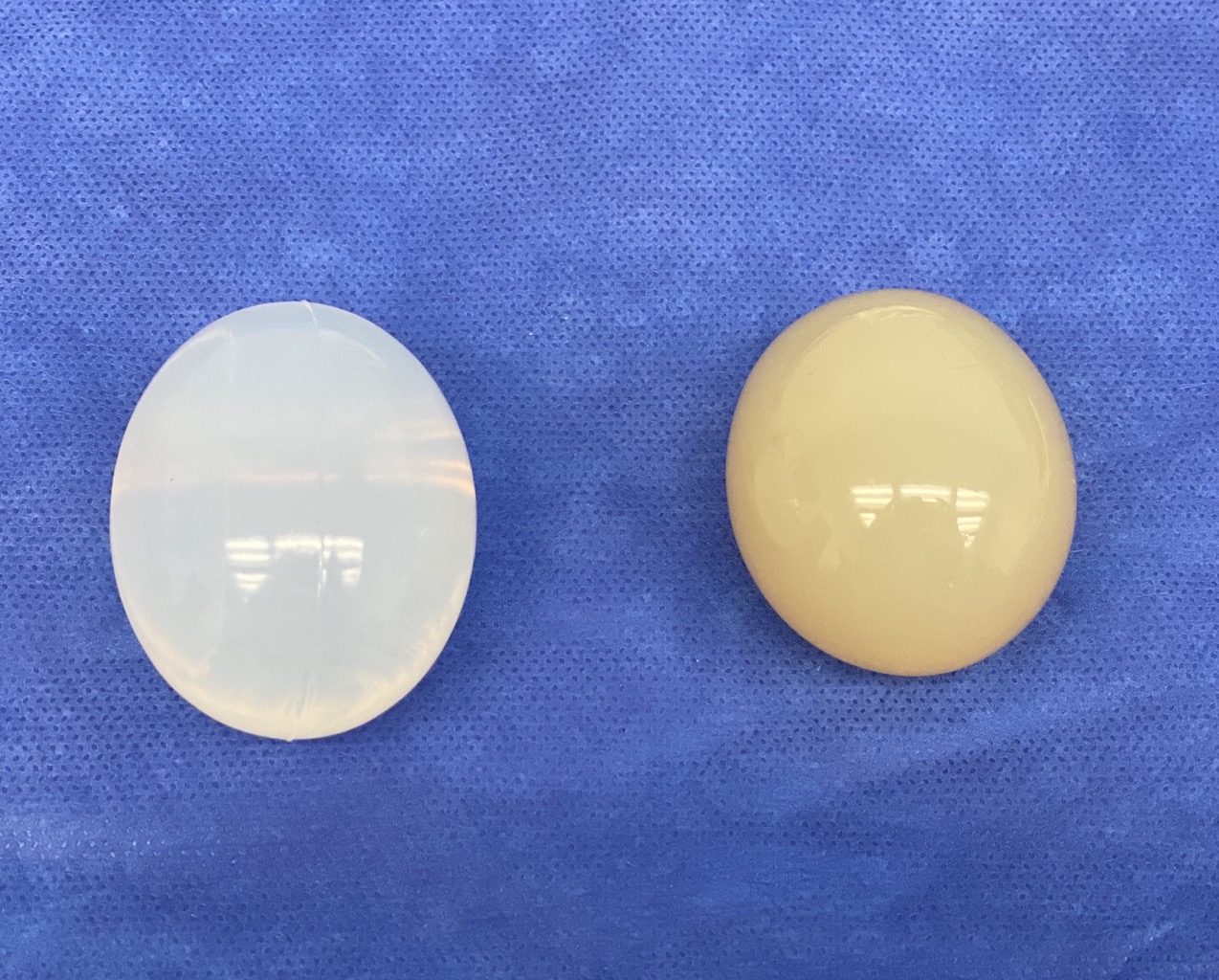 Plastic Surgery Case Study - Replacement of Old Hard Testicle Implant ...