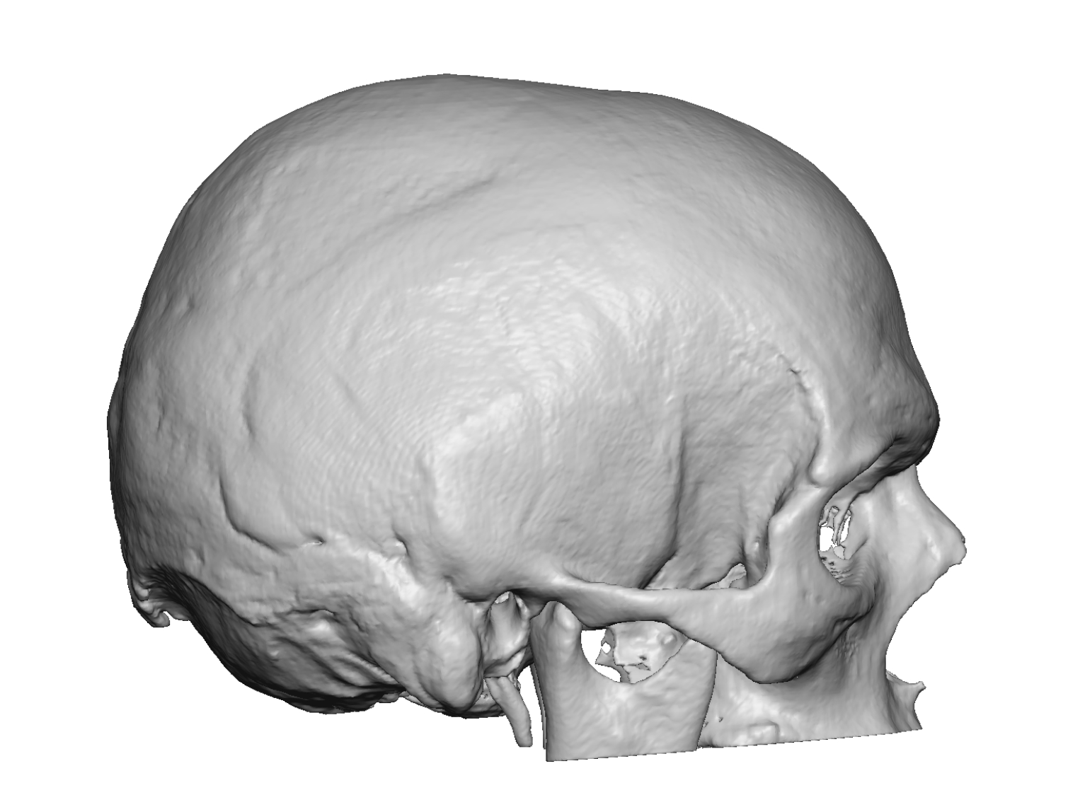 Plastic Surgery Case Study - Five Year Long Term Correction of the ...