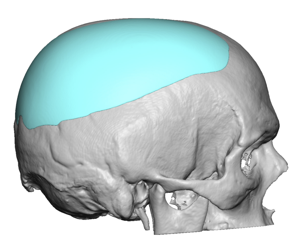 Plastic Surgery Case Study - Five Year Long Term Correction of the ...