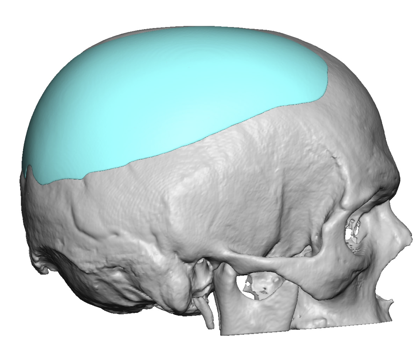Plastic Surgery Case Study - Five Year Long Term Correction of the ...