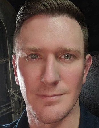 The Realities of Male Facial Masculinization Surgery Using Custom ...