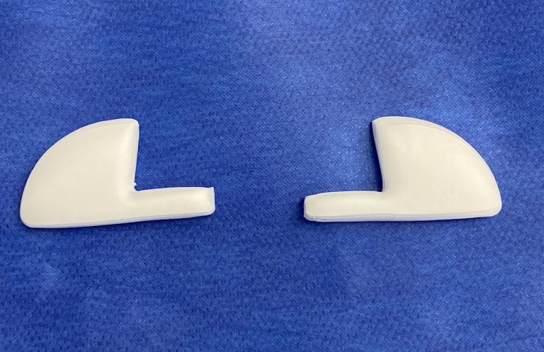 The ePTFE Paranasal Implant for Deeper Nasolabial Folds - Explore ...