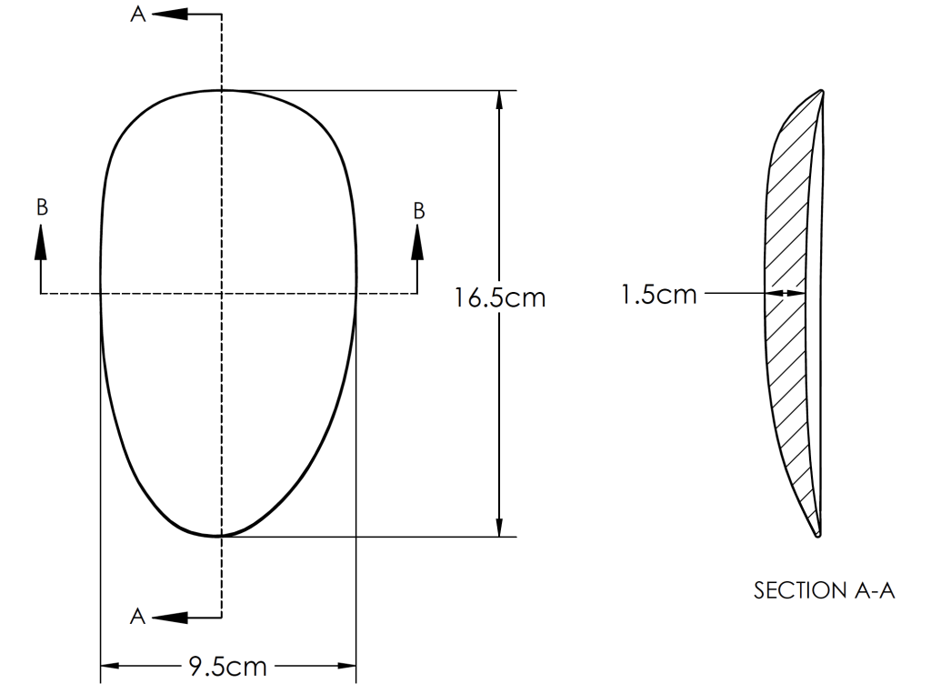 Plastic Surgery Case Study - Replacing Malpositioned and Fractured ...