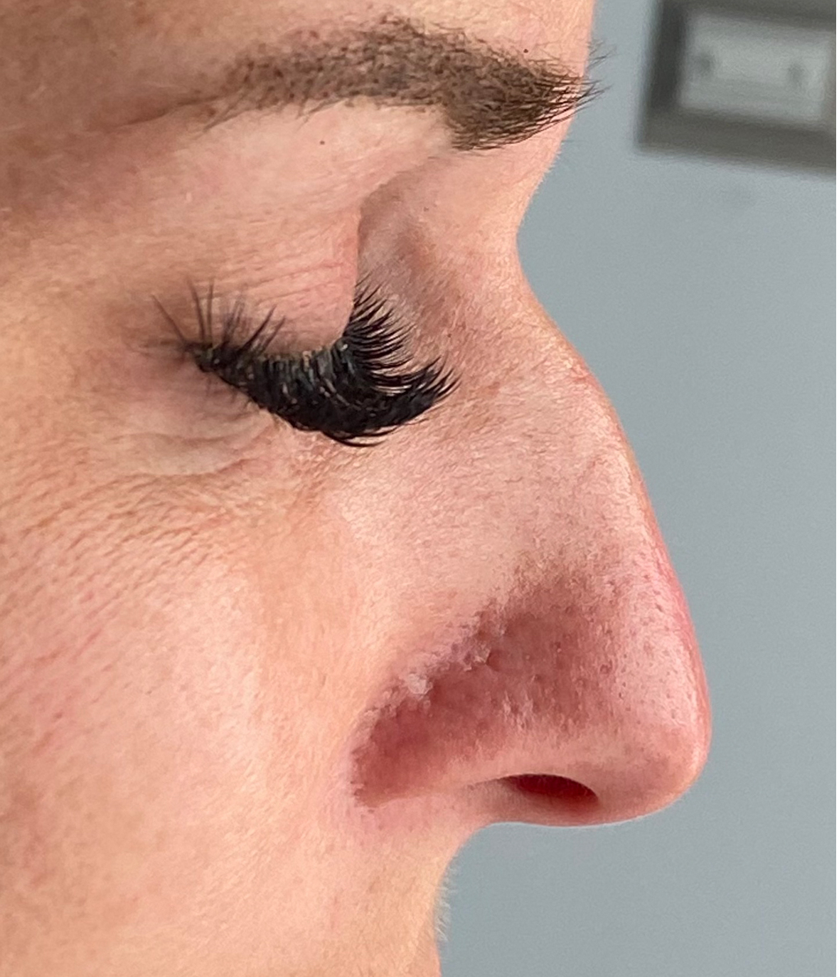 Plastic Surgery Case Study - Enabling A Faster Early Recovery in ...