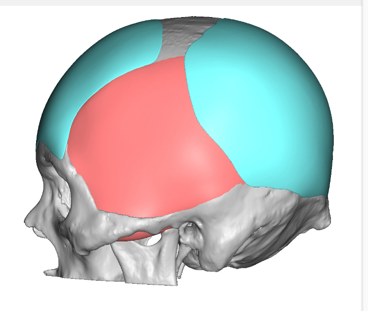 Plastic Surgery Case Study - Lengthening The Brachycephalic Head Shape ...