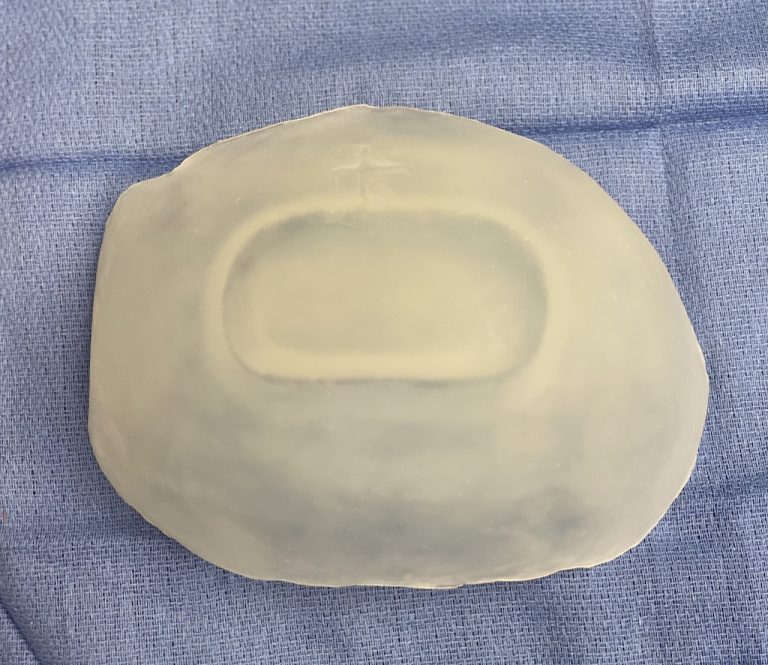 Plastic Surgery Case Study - Lengthening The Brachycephalic Head Shape ...