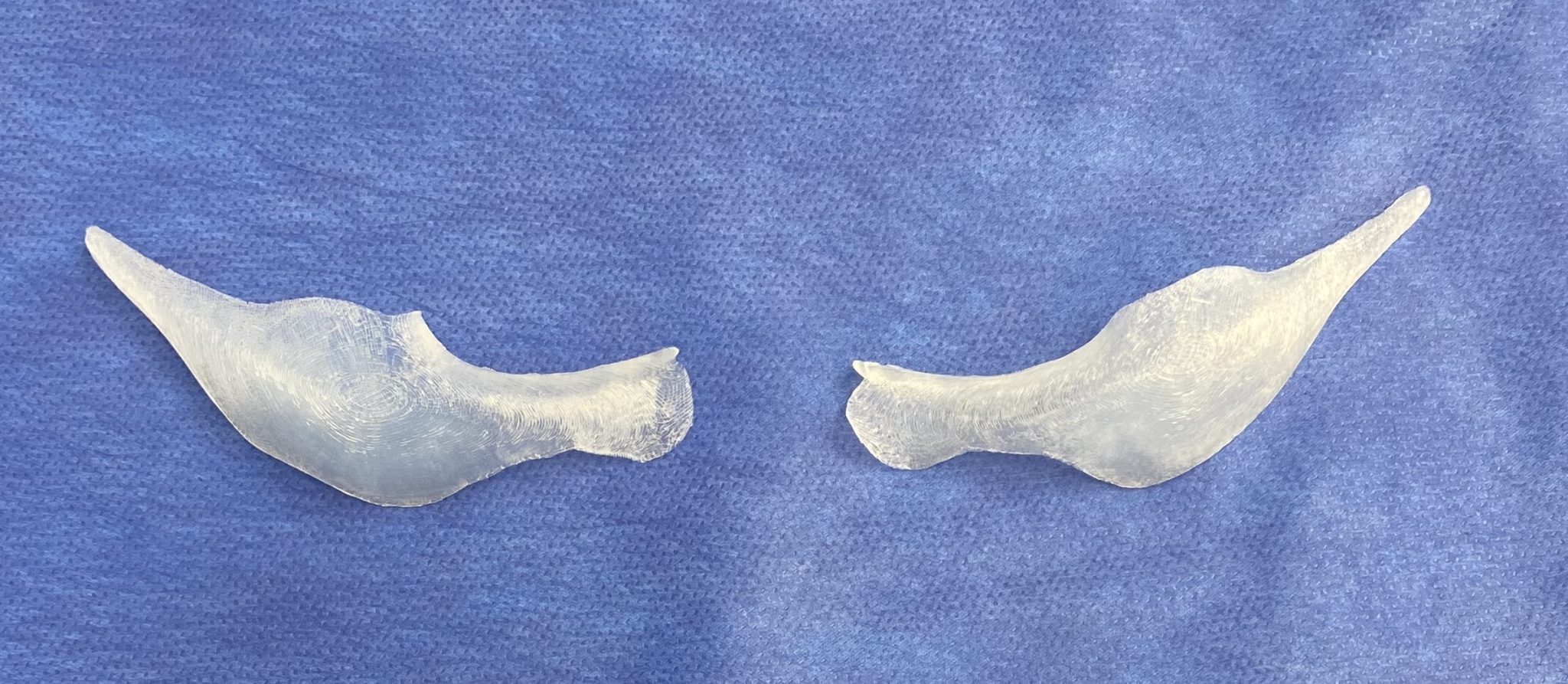 male custom IOM implants intraop Dr Barry Eppley - Explore Plastic Surgery