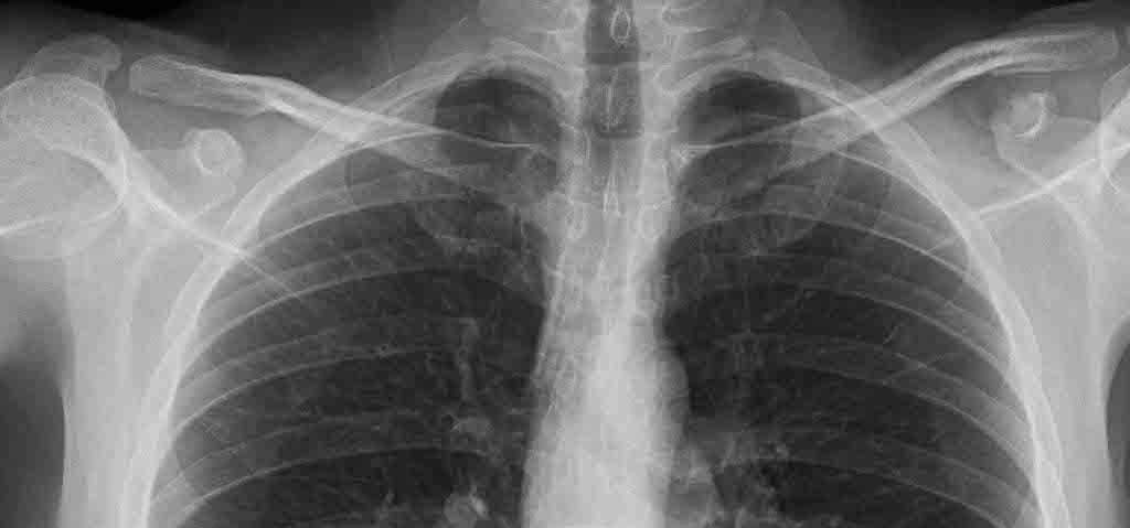 Plastic Surgery Case Study - Effectiveness, Scar Healing and Arm Motion ...