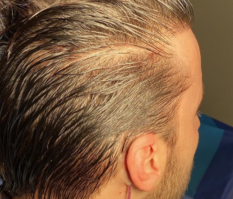 Plastic Surgery Case Study - Comprehensive Craniofacial Asymmetry ...