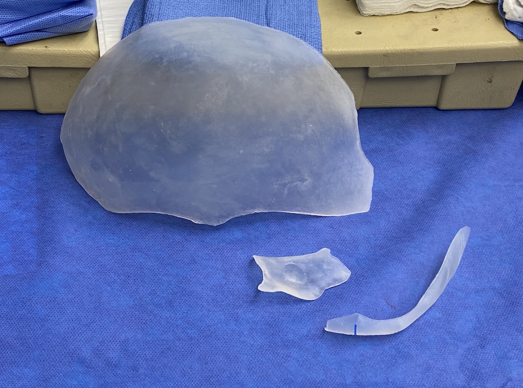 Plastic Surgery Case Study - Comprehensive Craniofacial Asymmetry ...