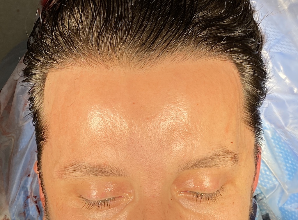 Plastic Surgery Case Study - Comprehensive Craniofacial Asymmetry ...