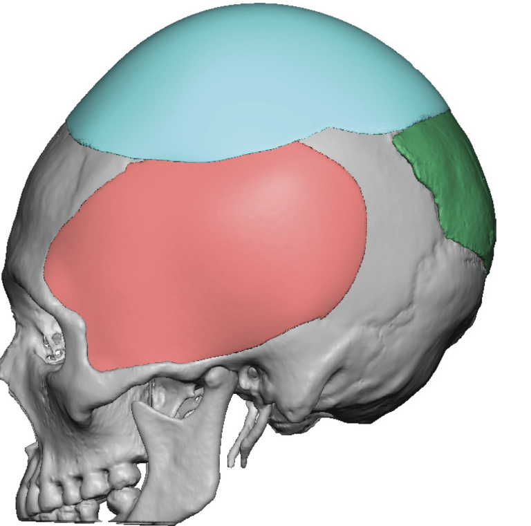 skull reshaping Archives - Explore Plastic Surgery
