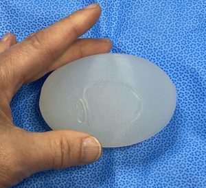 custom testicle implant softness 1 Dr Barry Eppley - Explore Plastic ...
