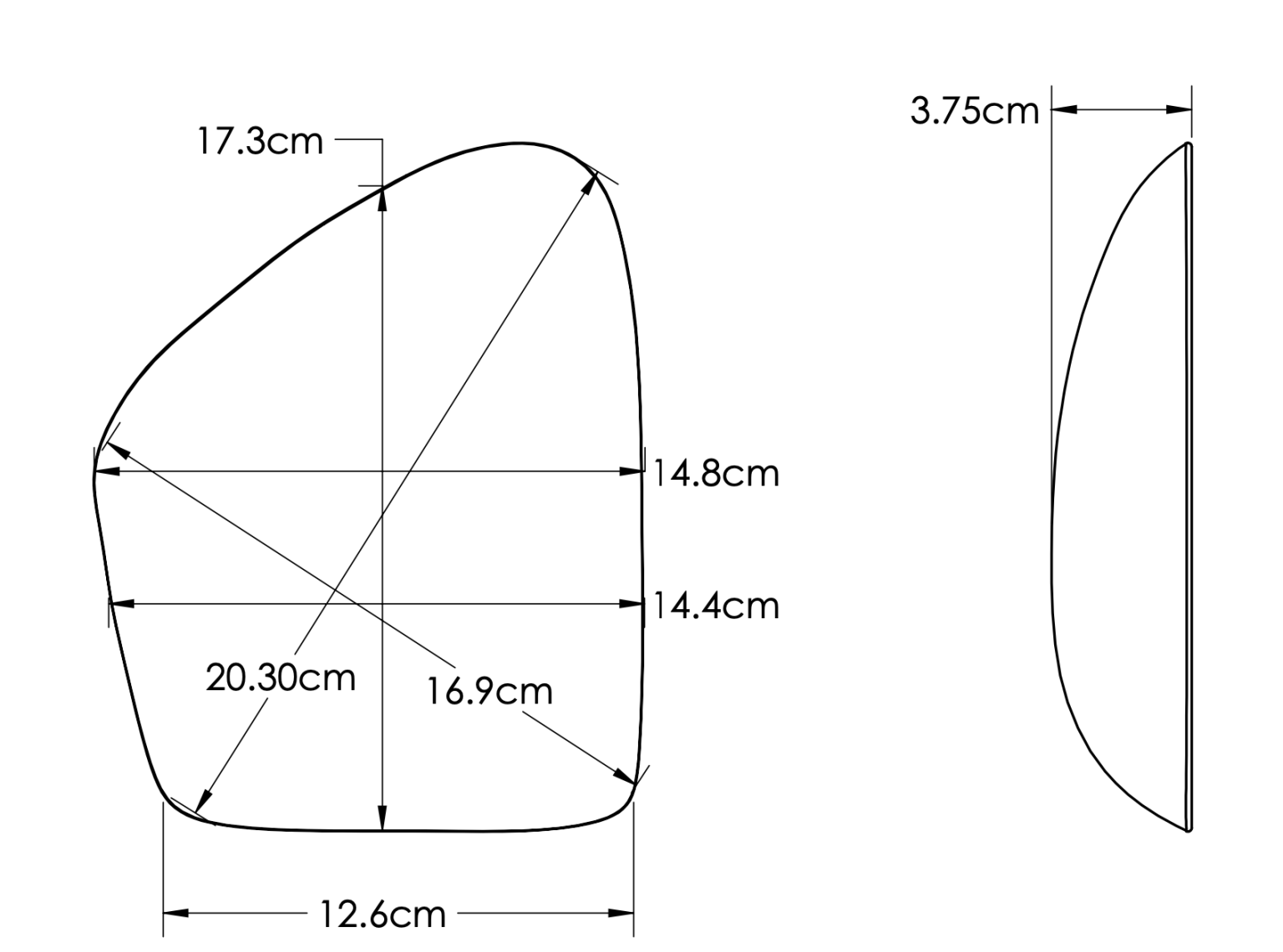 Plastic Surgery Case Study - Custom Pectoral Implant Replacements For ...