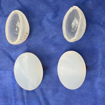 testicular implants Archives - Explore Plastic Surgery