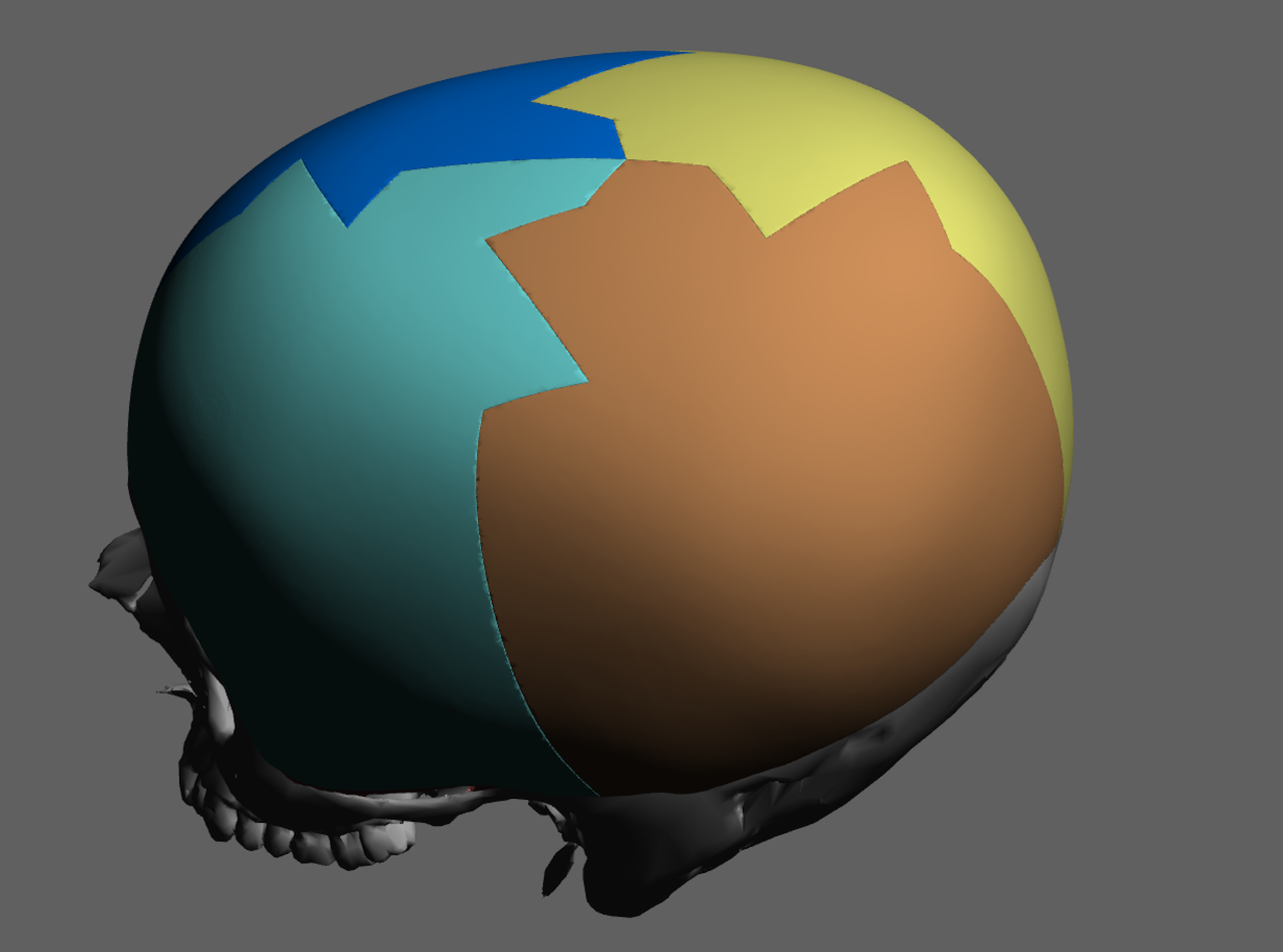 Plastic Surgery Case Study - A Segmentalized Technique for the ...