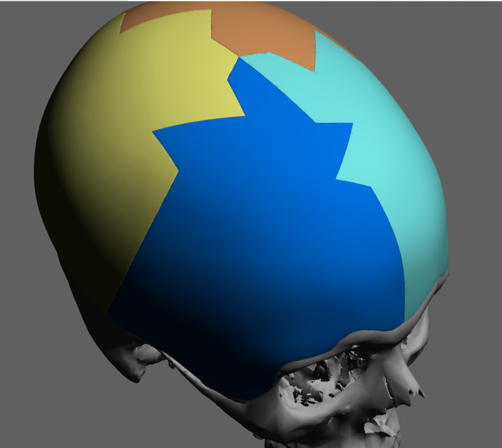 Plastic Surgery Case Study - A Segmentalized Technique for the ...