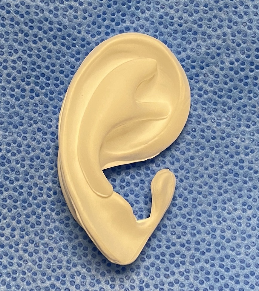 ePTFE-Coated Implant System for Ear Reconstruction - Explore Plastic ...